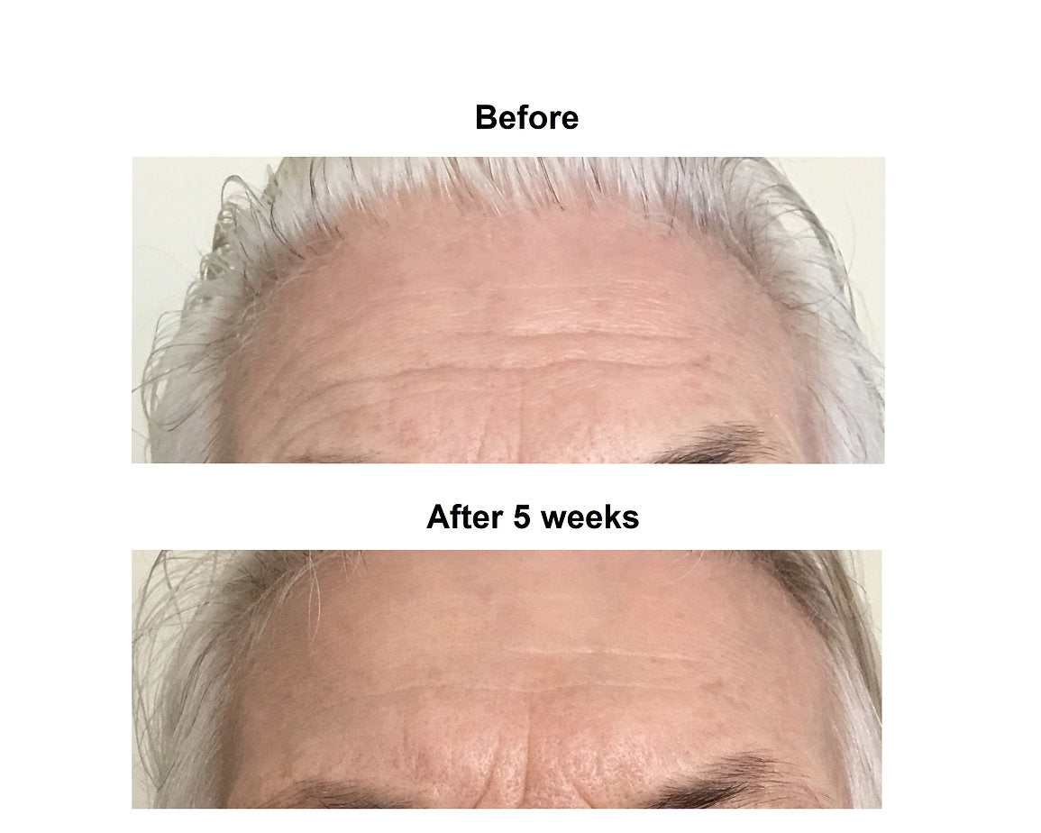 Crepey Skin Face FX - 2 oz (60 ml) | Triple K Collagen